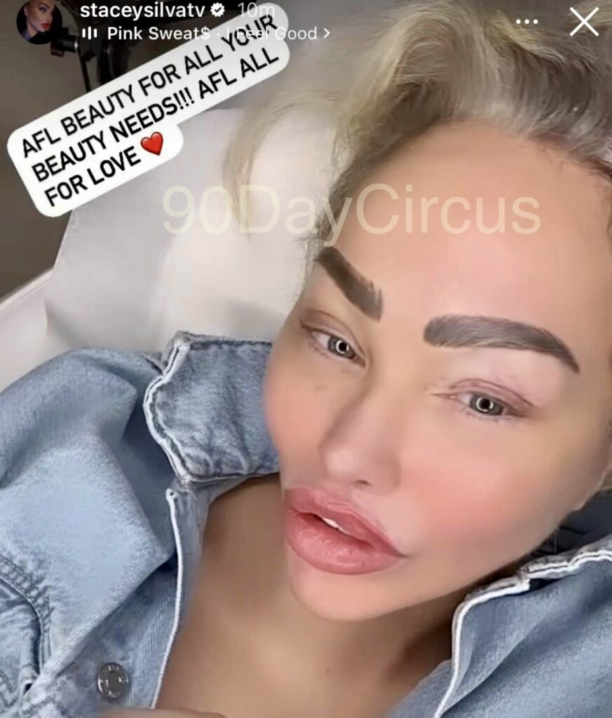 Stacey Silva's New Cosmetic Procedures: Shocking Pictures!