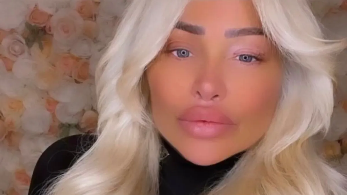 Stacey Silva's New Cosmetic Procedures: Shocking Pictures!